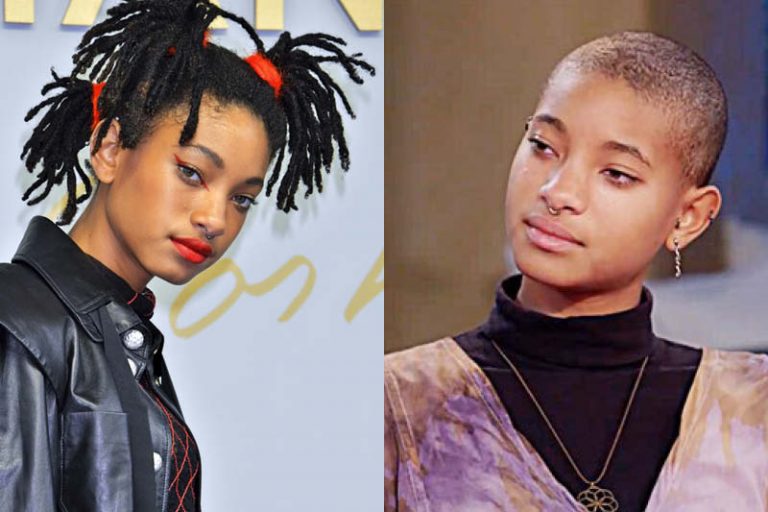 20 Most Badass Bald Women Of All Time - Lady Alopecia